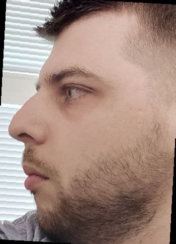 How To Increase Face Recognition Quality On My Data Issue Deepinsight Insightface