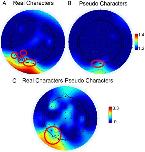 Topographic Plots For Intermodulation Response At F1 F2 13 5 Hz Read Download Scientific