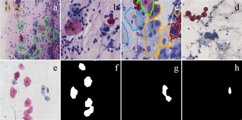 Figure 1 From Conventional Cervical Cytology Image Dataset With Cell Outline Annotations