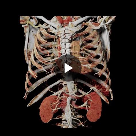 This 3d Imaging And Axial Dataset Contain Numerous Irregularities Stanford 3d And Quantitative