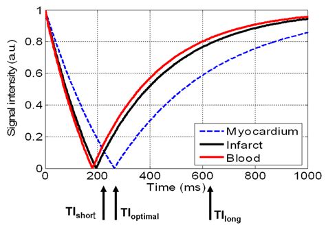Signal Intensity Curves Illustrating The Signal Intensities At Download Scientific Diagram