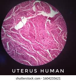 Both Male Female Reproductive System On Stock Photo Shutterstock