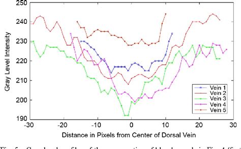 Metacarpophalangeal Joint Structure Semantic Scholar