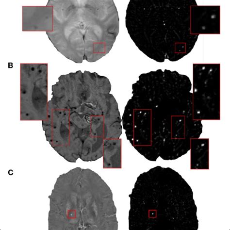 Figure Examples Of The Final Fast Radial Symmetry Transform Frst Download Scientific Diagram