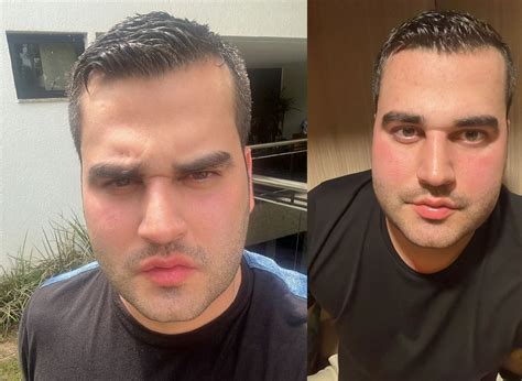 Jovem Victor Bezerra Voltou Com O CoraÇÃo Nas MÃos De CarnÁ Recifense Cariri é Isso