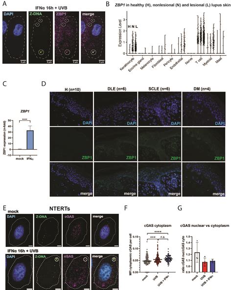 Mitochondrial Z Dna And Zbp1 Drive Autoimmune Photosensitivity Acr Meeting Abstracts