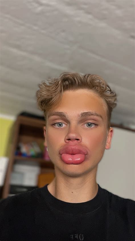 Bimbo Lips By Big0lips On Deviantart