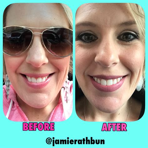 My Fashionable Designs Adult Braces I Got Bracesagain