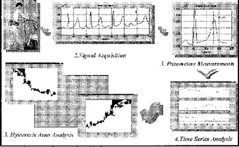 Figure 4 From Diagnostic Value Of Qt Interval Hysteresis Loop In