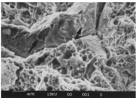Partially Intercrystalline Fracture With Ductile Marks On