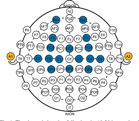 Figure 1 From Effects On Cortical Rhythms Produced By Robotic Glove Assistance During Motor
