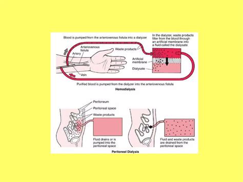 Urinarysystemdisorderspptx