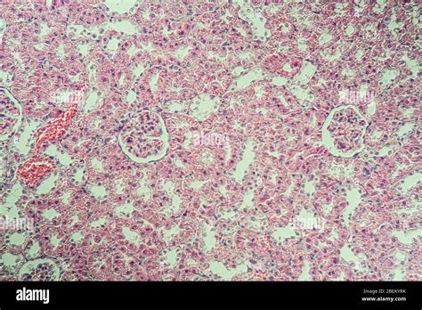 Renal Cortex Banque De Photographies Et Dimages à Haute Résolution Alamy