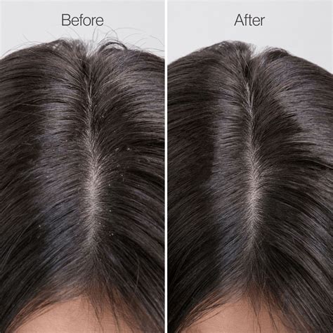 Freewill Gentle Exfoliating Scalp Scrub Sally Beauty