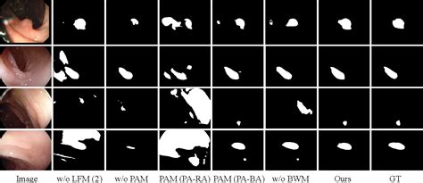 Figure 11 From Multi Scale Information Sharing And Selection Network With Boundary Attention For