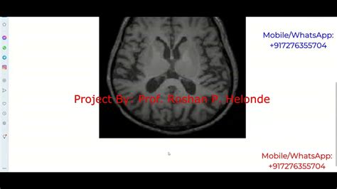 Types Of Brain Tumor Detection Using Image Processing Python Project With Source Code Youtube
