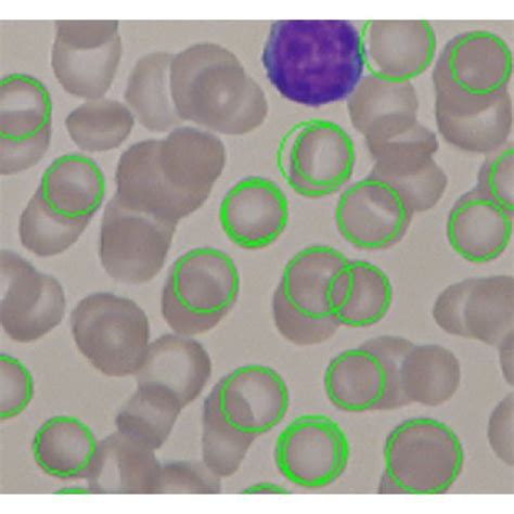 A Cht Rbcs Detection Results And B Our Proposed Method Rbcs Download Scientific Diagram