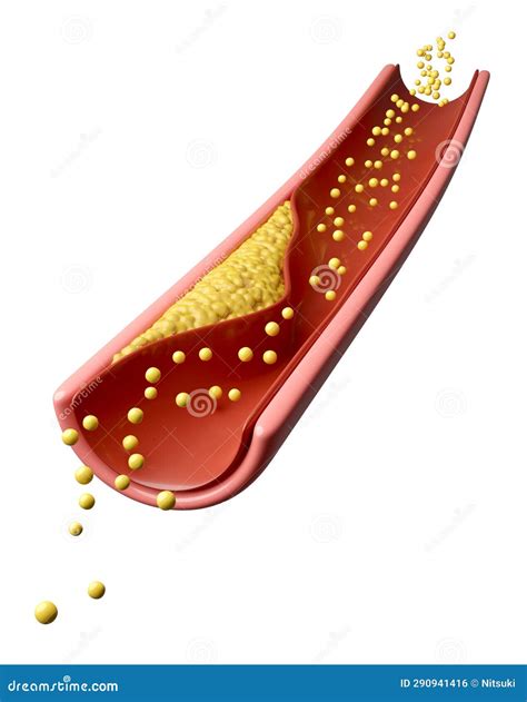 High Cholesterol Icon On White Background Symptoms Of Metabolic