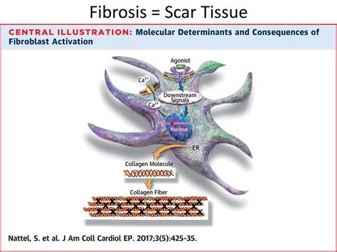 Clinical Trials In Scleroderma Ppt