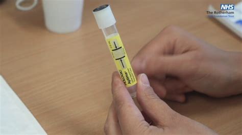 How Accurate Is The Std Urine Test 3 Things To Know