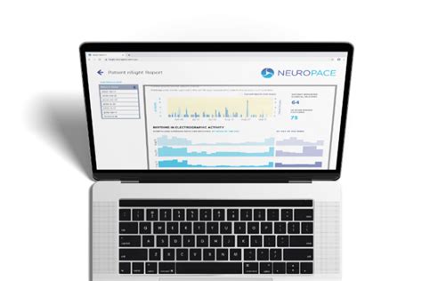 The Rns System Personalized Neuromodulation Therapy