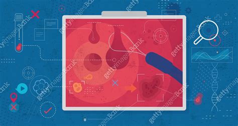Colonoscopy Concept 이미지 1789095722 일러스트 무료 일러스트 아이콘 무료 아이콘 게티이미지뱅크