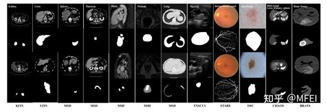 论文精读Medical Image Segmentation Using Deep LearningA Survey 知乎