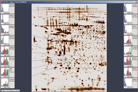 Global Analysis Of Normal Vaginal Tissue Vaginal Cancer And Cervical Download Scientific