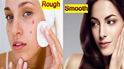 How To Make Rough Face Skin Soft And Smooth Youtube