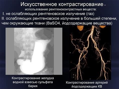 Лучевая диагностика, методы лучевого исследования - презентация онлайн