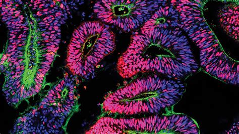 Non Coding Rnas In Nervous System Function And Disease