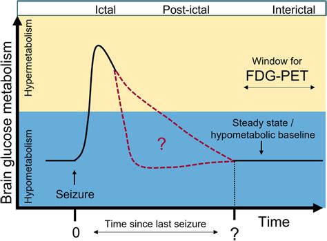 Graphic Conceptualization Of Dynamic Brain Glucose Metabolism Following Download Scientific