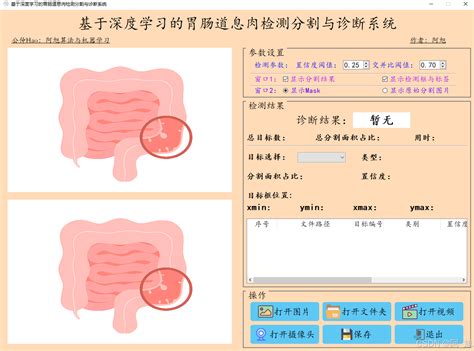 基于yolo11深度学习的胃肠道息肉智能检测分割与诊断系统【python源码pyqt5界面数据集训练代码】深度学习实战、目标分割、人工