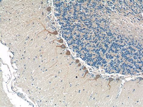 Csf1r Cd115 Antibody 25949 1 Ap Proteintech