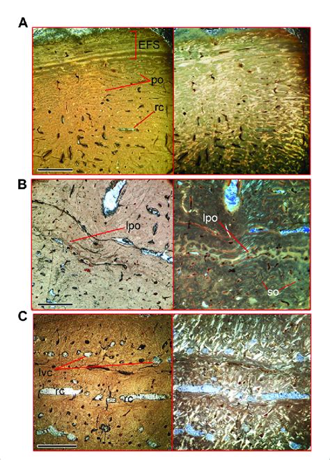 Microanatomical Structure Of The Vertebral Cortex Of Lumbar Vertebra