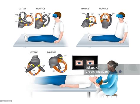 General Dixhallpike Test With Glasses Stock Illustration Download