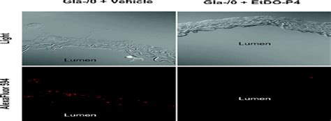 Decreased Nitric Oxide Bioavailability In A Mouse Model Of F Journal Of The American