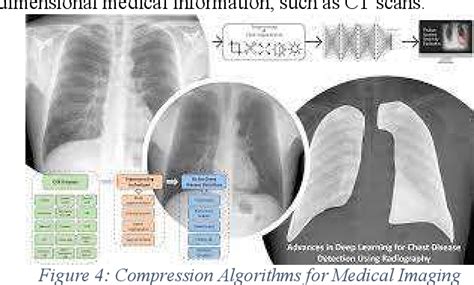 Figure 4 From Efficient Data Compression Algorithms For Cloud Based Medical Imaging Semantic