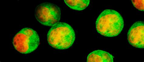 Supercontinuum Laser In Photoluminescence Spectroscopy Advances In