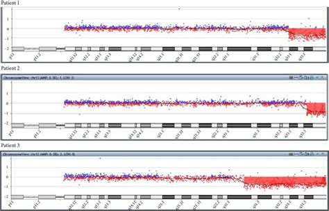Acgh Profile Indicating The Segment Deletions On Chromosome 13q Download Scientific Diagram