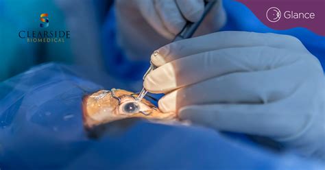 New Consensus Guidelines Published For Suprachoroidal Space Injections