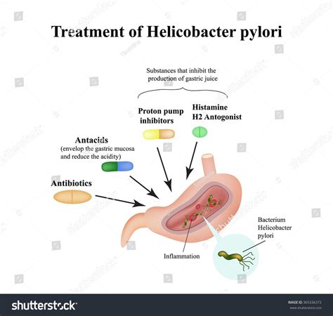 4 H2 Blockers Diagram Stock Vectors And Vector Art Shutterstock