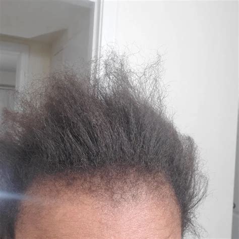 How To Identify And Treat Heat Damaged Hair Livara Natural Organics