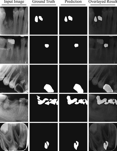 Qualitative Results Of Proposed Self Supervised Learning Strategy For