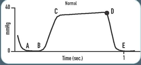 Etco2 Flashcards Quizlet