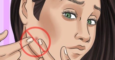 6 Ways To Get Rid Of A Pimple Naturally Health Recipes Article