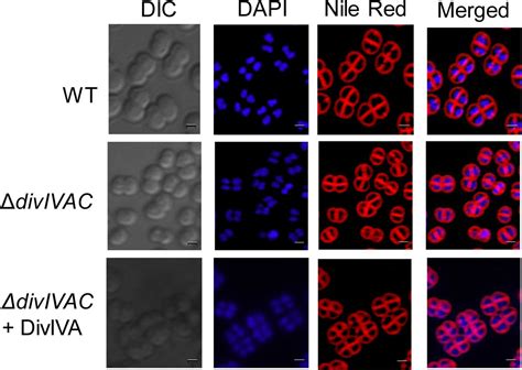 Deinococcus Radiodurans Gram Stain Understanding The Survival
