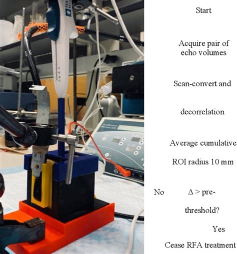 Figure 1 From Control Of Radiofrequency Ablation In Ex Vivo Human Liver Tissue Using 3d Echo