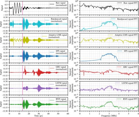 Figure 5 From Comparison Of Deep Learning And Signal Processing Methods For Removing A Ringing