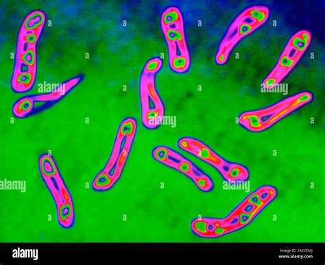 Diphtheria Bacteria Coloured Transmission Electron Micrograph Of A Section Through A Group Of